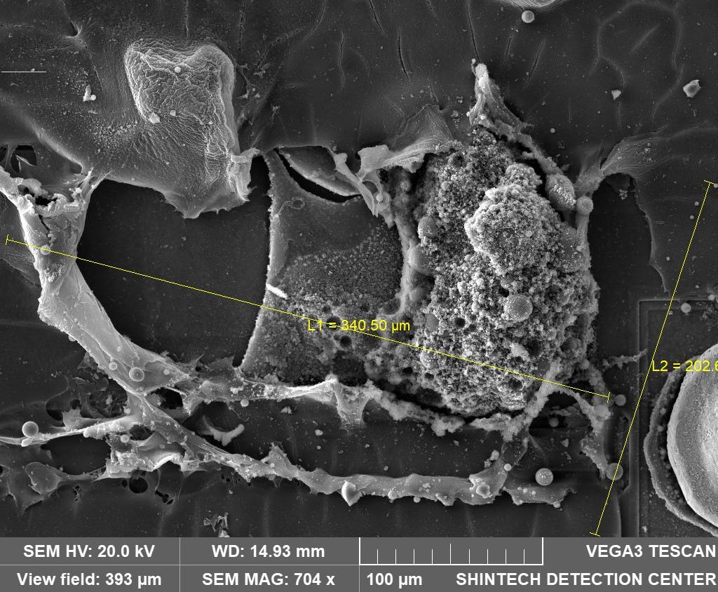 ESD与EOS失效案例分享_eos损伤的预防-CSDN博客