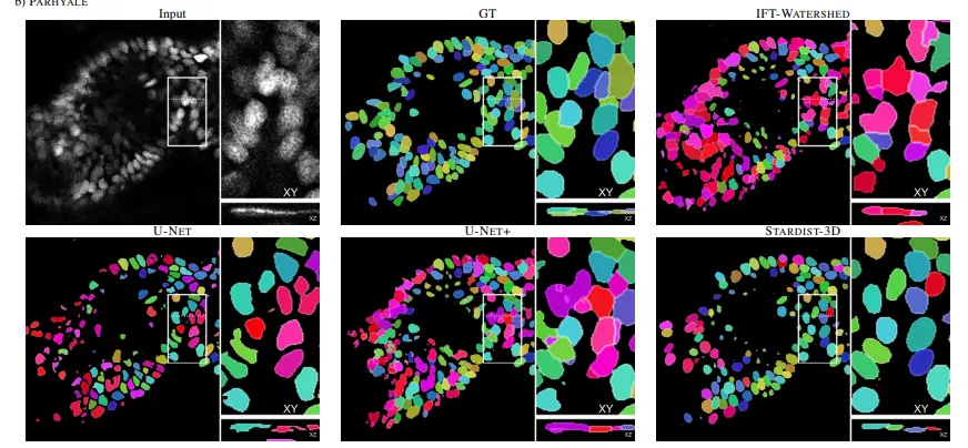 ISS空间转录组的细胞分割算法汇总(stardist、cellpose、QuPath、SCS)_python qupath-CSDN博客