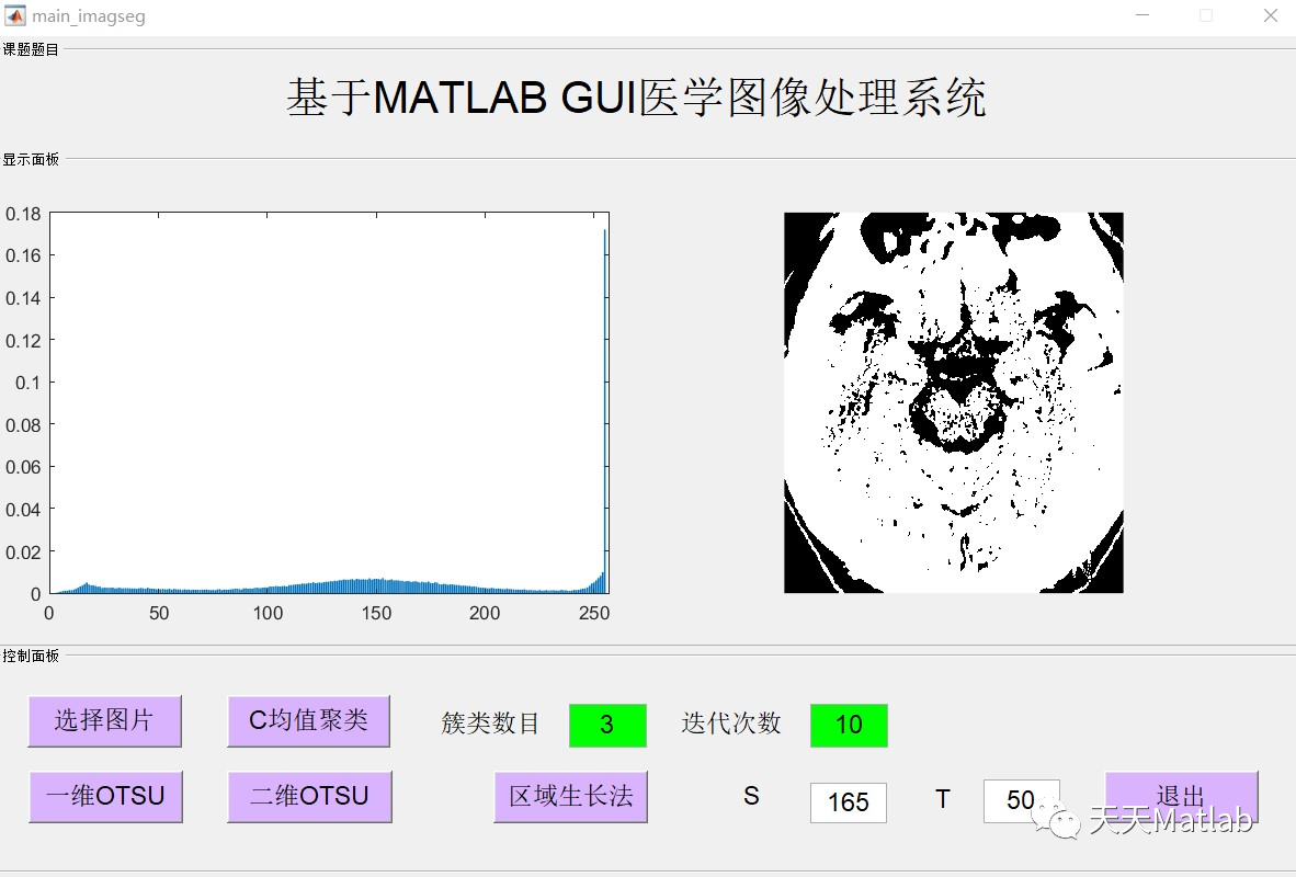 【图像分割】基于均值聚类oust区域生长法实现mri图像分割附matlab代码基于深度学习分割医学影像matlab代码 Csdn博客