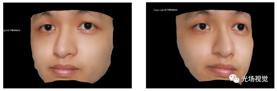 国内外光场相机应用案例对比_微透镜缺陷检测 csdn-CSDN博客