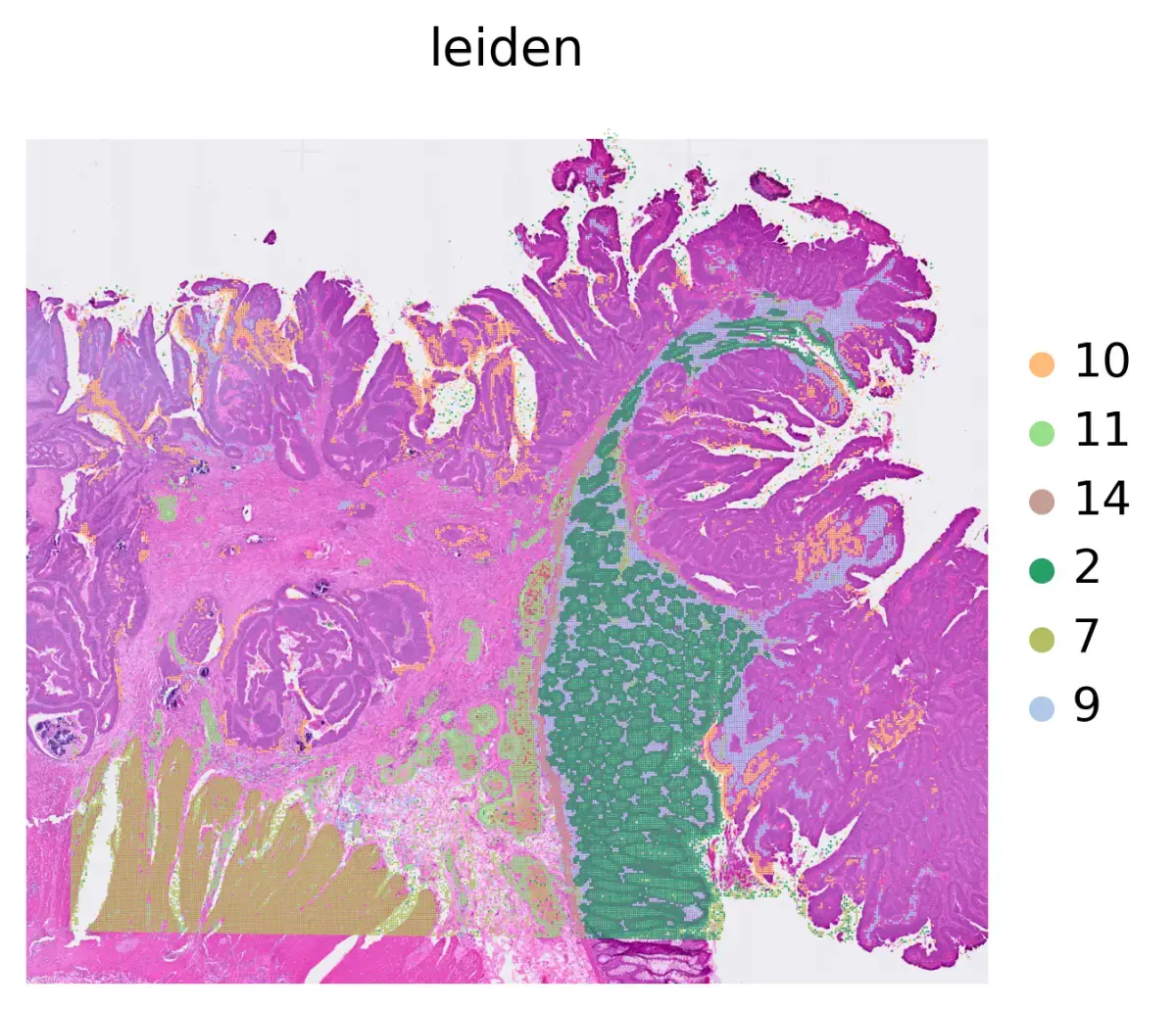 10X空间转录组Visium && HD && Xenium分析全更新_10x visium和hd的区别-CSDN博客