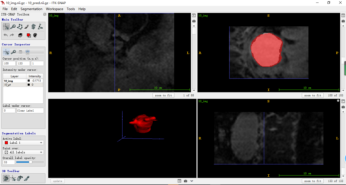 ITK-SNAP基础教程_itk snap-CSDN博客