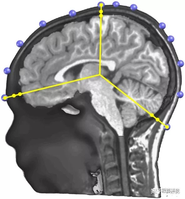 脑电图源成像:分析步骤的实践回顾_脑电源定位的步骤-CSDN博客