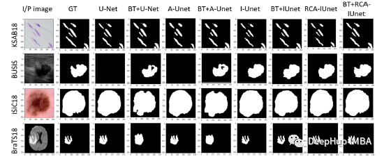 BT-Unet:医学图像分割的自监督学习框架-CSDN博客