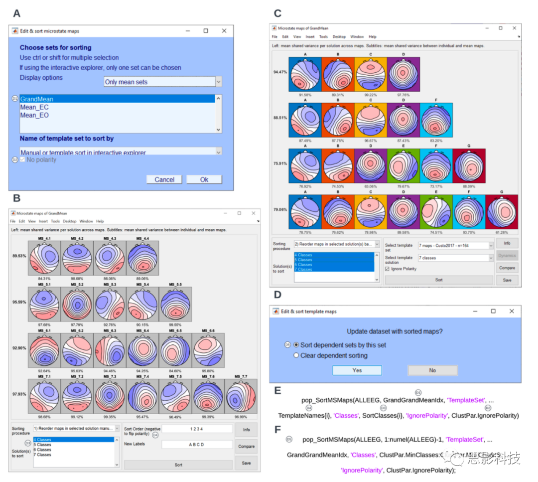 MICROSTATELAB：用于静息状态微状态分析的EEGLAB工具箱_matlab脑电静息态分析-CSDN博客