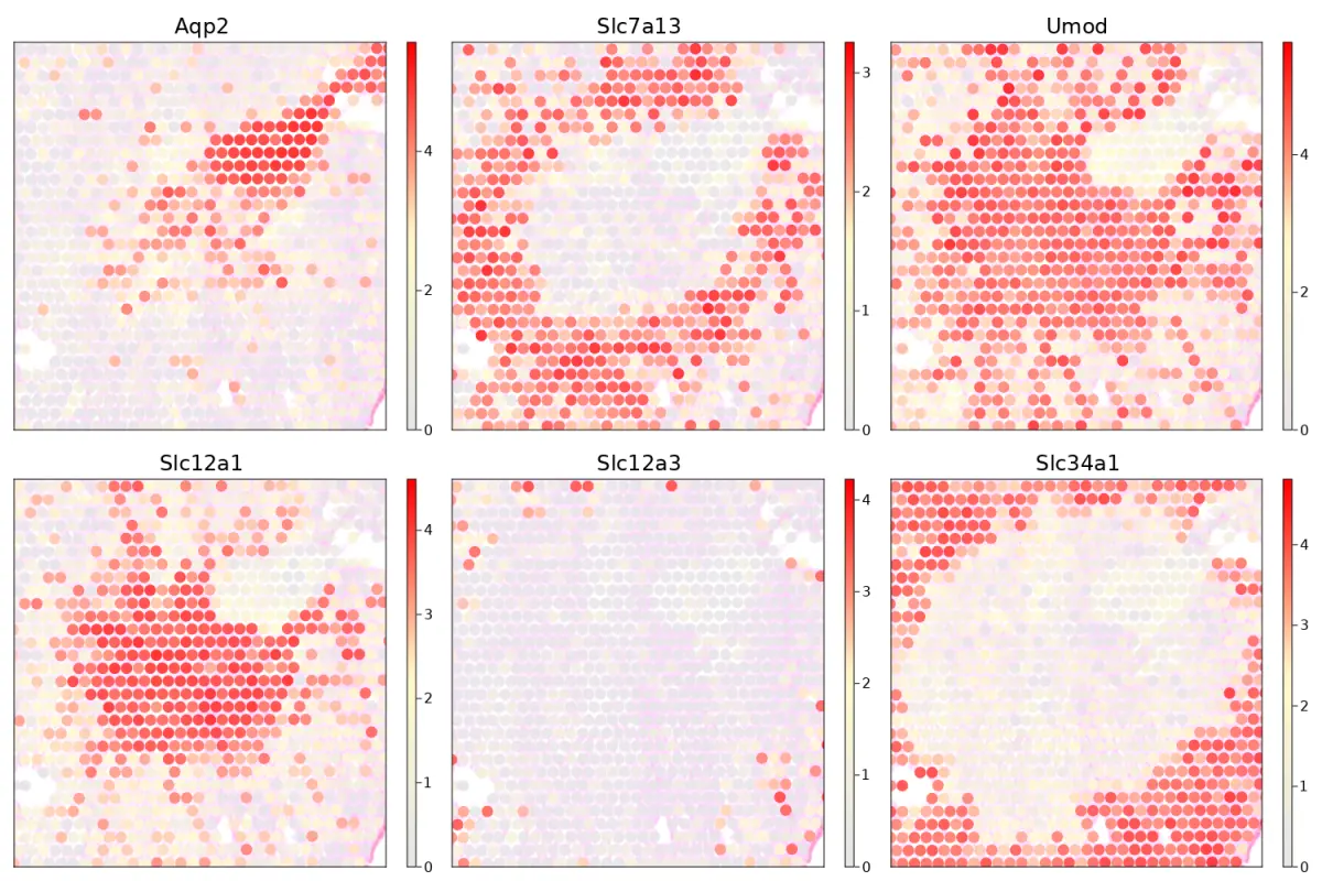 10X空间转录组Visium && HD && Xenium分析全更新_10x visium和hd的区别-CSDN博客
