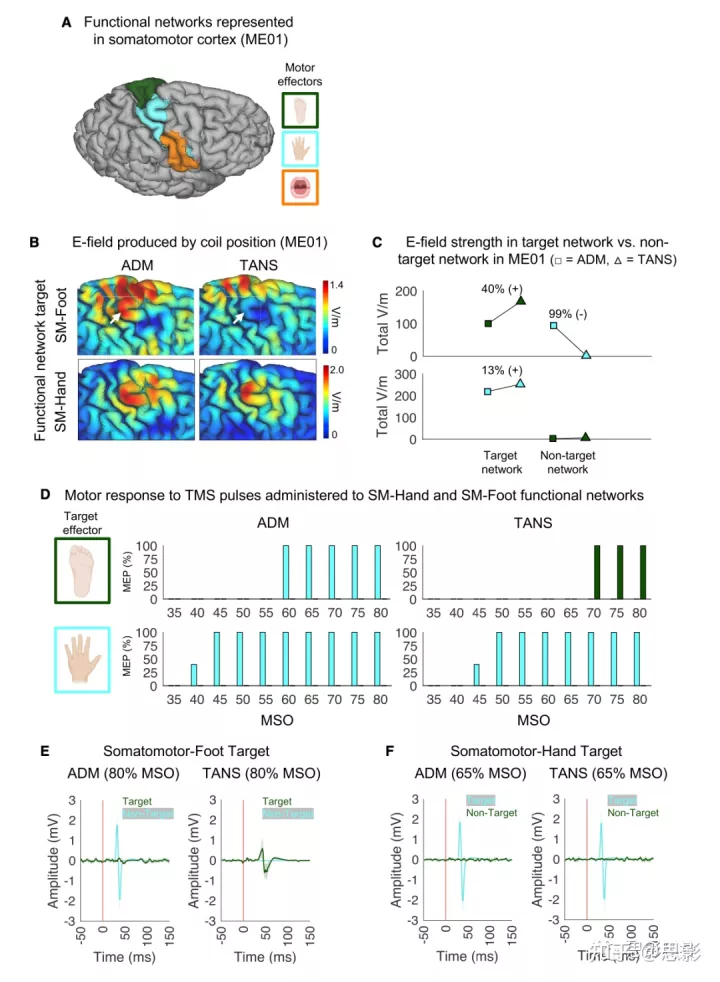 Neuron：自动优化TMS线圈放置，实现个性化靶向功能网络刺激_somatomotor-CSDN博客