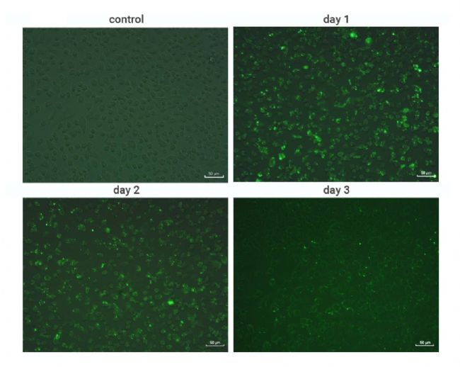 干货分享 | 如何做 RNA 干扰实验？(常见问题+解决方案）_rnai干扰技术图示-CSDN博客