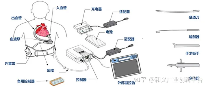心脏机械辅助装置（PVAD）ECMO人工心脏厂家-CSDN博客