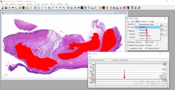 判断点击区域_如何采用Image Pro Plus测量病变区域的总面积？_weixin_39717026的博客-CSDN博客