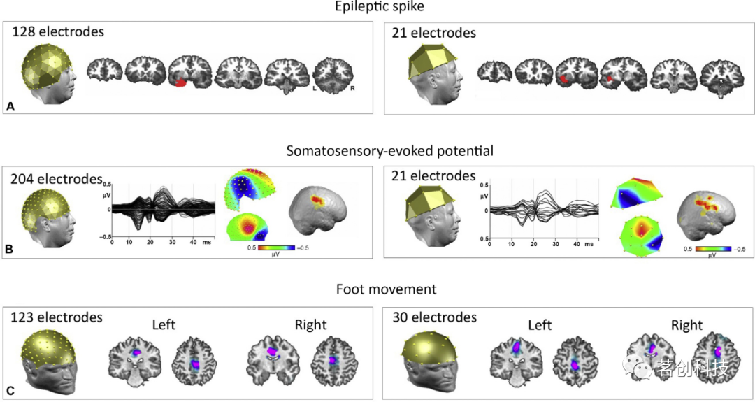 高分辨率EEG的空间分析-CSDN博客