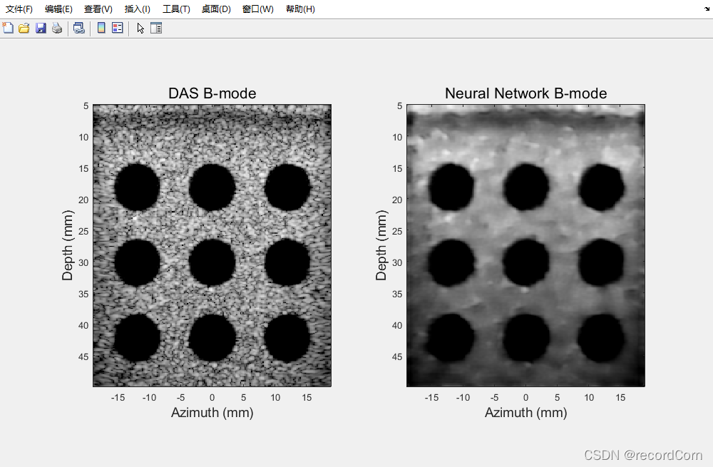 利用神经网络进行超声波束合成(Colab Tensorflow)-CSDN博客