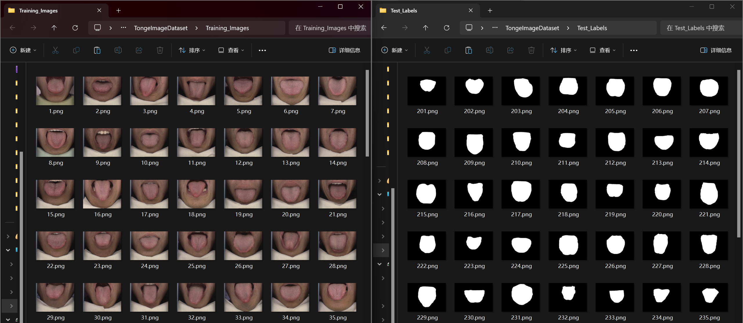 【2024年毕设系列】手把手教你用Unet++做舌象分割_unet++网络结构-CSDN博客