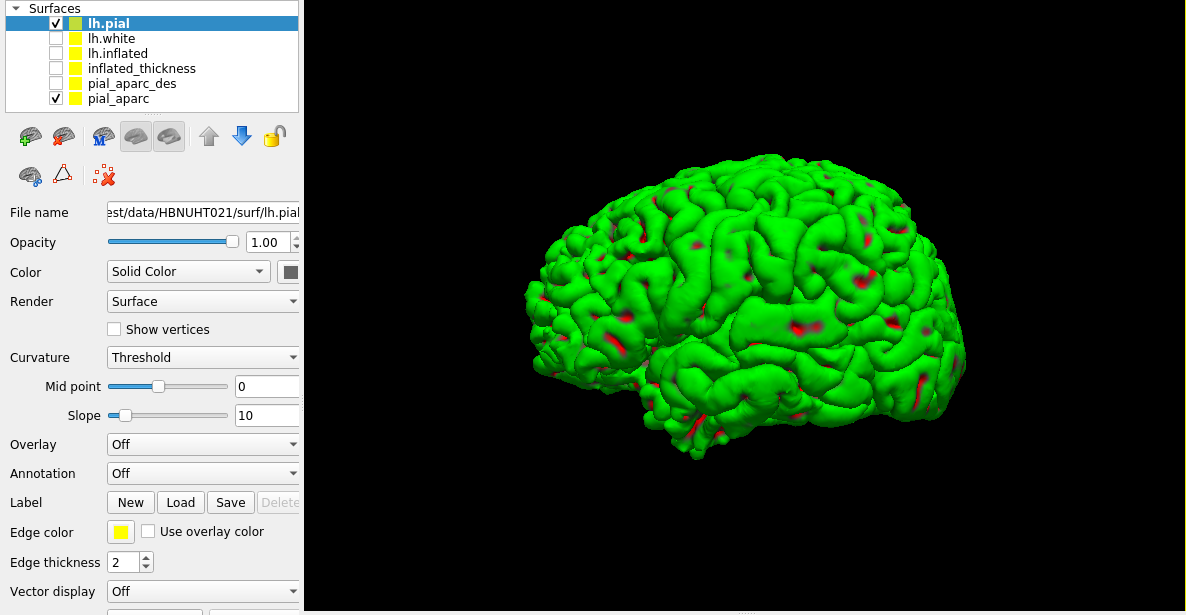 freesurfer全过程梳理-CSDN博客