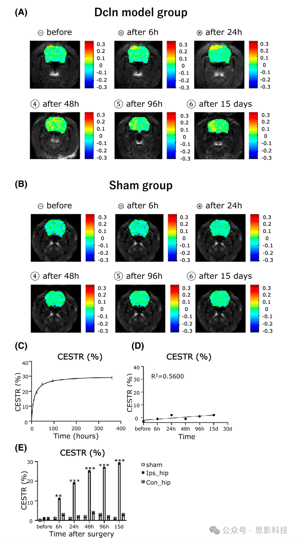 磁共振成像评估脑淋巴系统活性_dti alps-CSDN博客