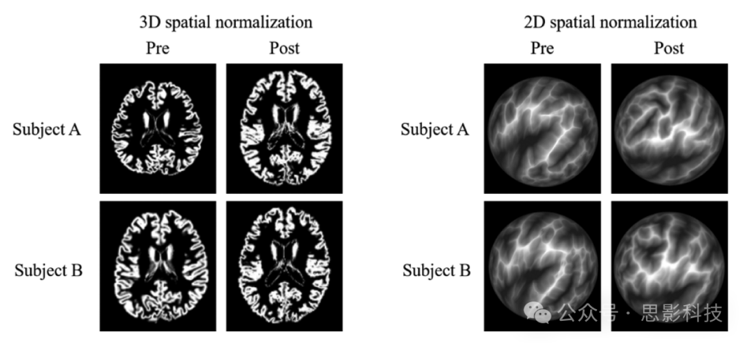 使用VBM和SBM在皮质形态分析中的优势_表面形态学测量技术sbm用t1wi图像可以吗-CSDN博客