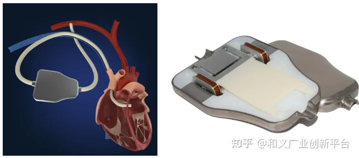 心脏机械辅助装置（PVAD）ECMO人工心脏厂家-CSDN博客