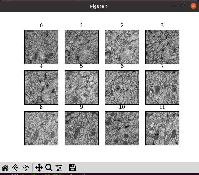 MindSpore社区活动：UNet-2D的图像分割_2d unet-CSDN博客