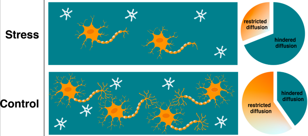Restriction spectrum imaging (RSI)-CSDN博客