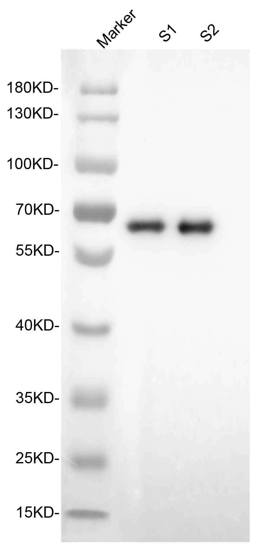 蛋白质印迹法图像结果分析WB检测技术_保存wb结果图片的时候,需要单独保存maker吗-CSDN博客
