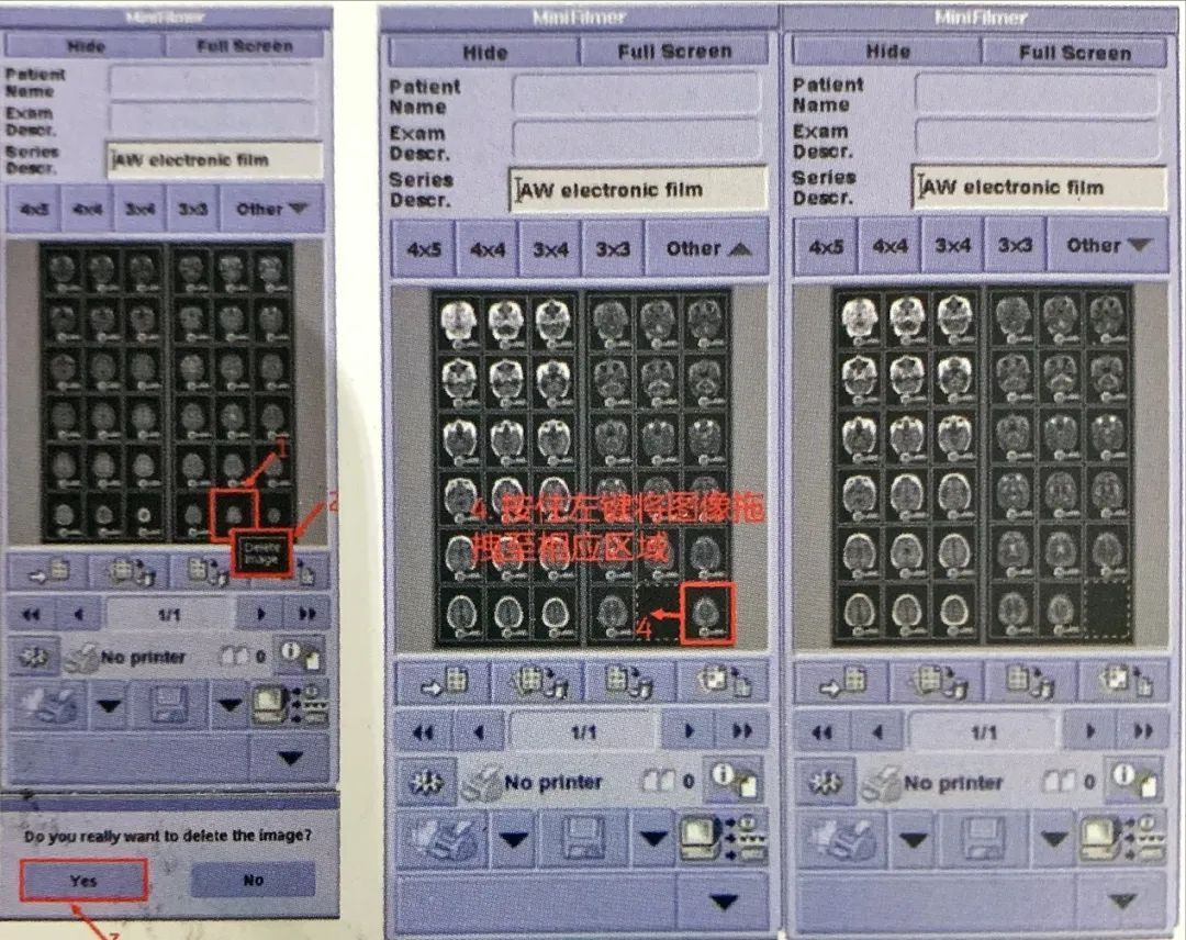 layui 隐藏工具栏打印按钮_技术分享 | GE MR AW4.7胶片打印_weixin_39991531的博客-CSDN博客