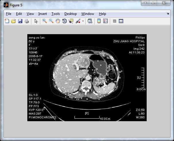 Matlab医学图像分割区域生长-CSDN博客
