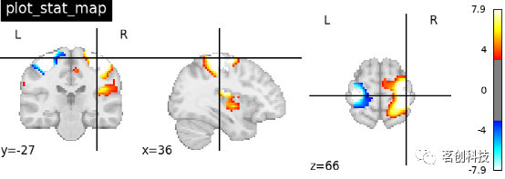 Nilearn：绘制大脑图像-CSDN博客