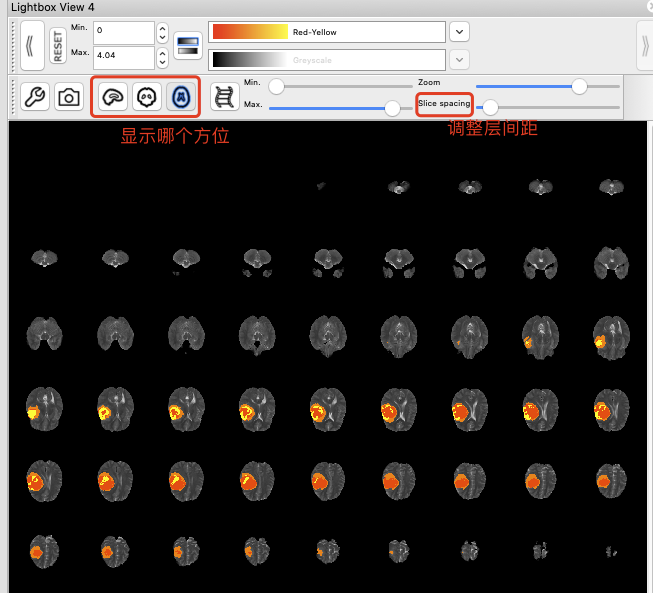 fsleyes -- 一款多功能影像数据查看器_fsleyes updating the texture data-CSDN博客