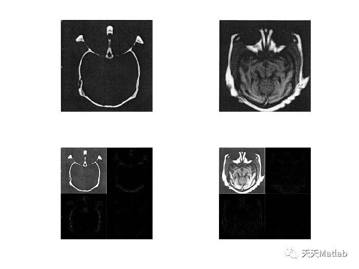 【图像融合】基于梯度能量、局部能量、 PCA三种融合规则实现MRI-CT图像融合附matlab代码_单向梯度补偿融合算法代码-CSDN博客
