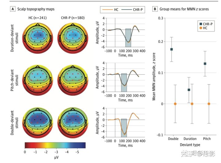 JAMA Psychiatry：临床精神疾病高危青少年对听觉异常反应的MMN与未来精神疾病的风险_mmn oddball范式-CSDN博客