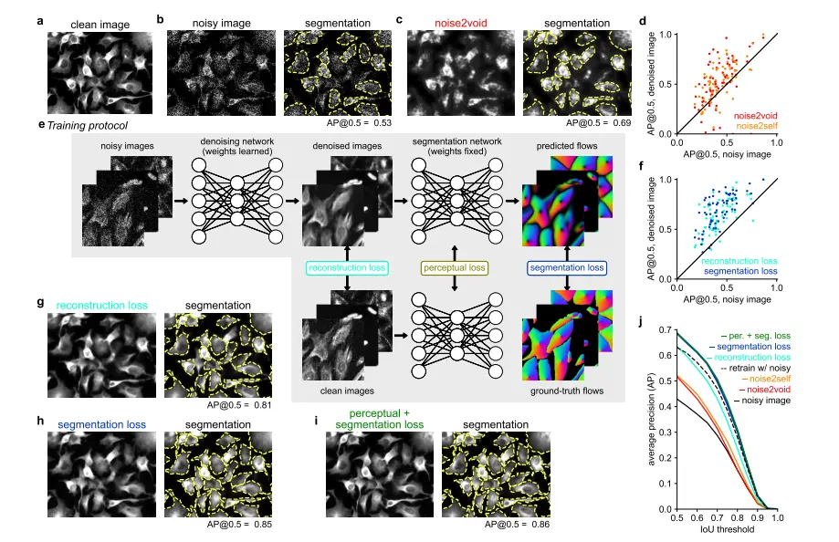 ISS空间转录组的细胞分割算法汇总(stardist、cellpose、QuPath、SCS)_空间组学-iss-CSDN博客