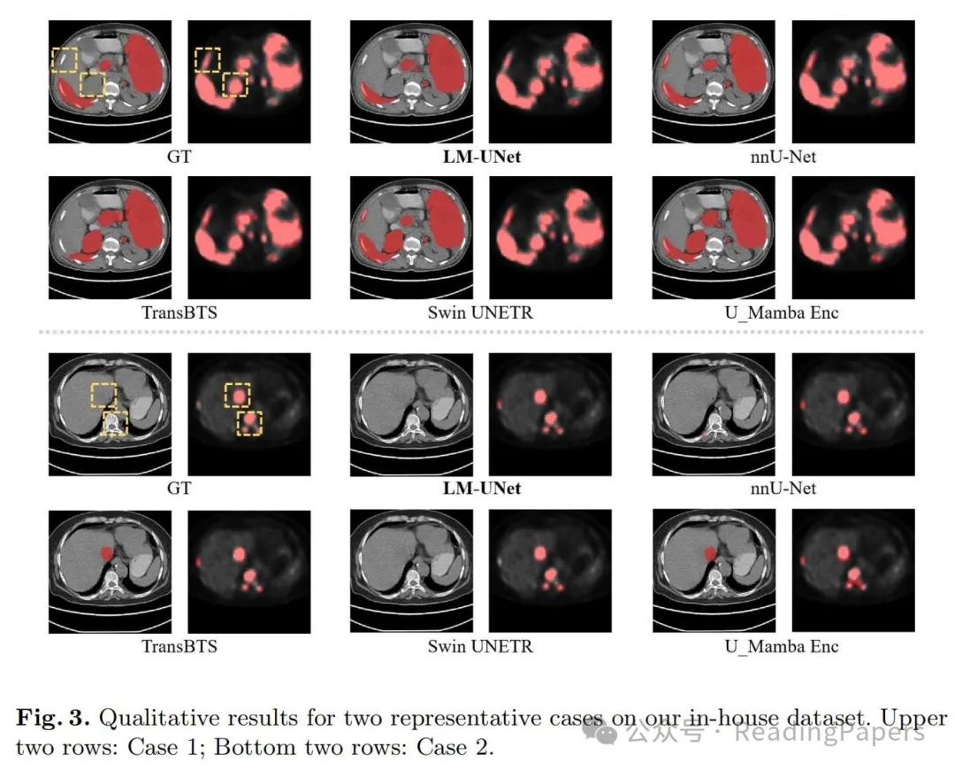 医图顶会 MICCAI‘24 | LM-UNet: 用于全身CT分割的双模态注释的Mamba U-Net网络_lm-unet: whole-body pet-ct lesion ...