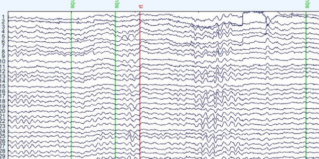 eeg数据集_eeglab教程系列(1)-加载、显示数据-CSDN博客