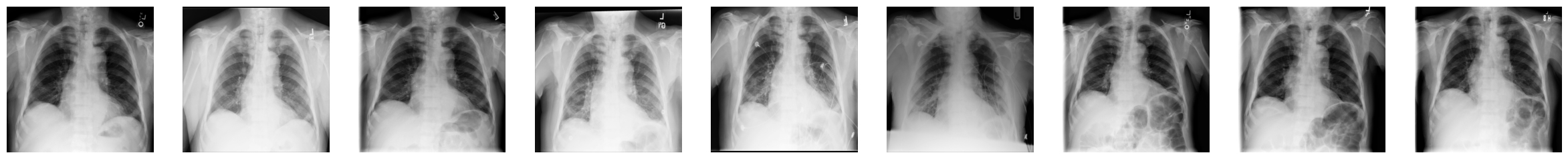 NumPy 应用：X射线图像处理_射线扫描里面的grayscale plot-CSDN博客