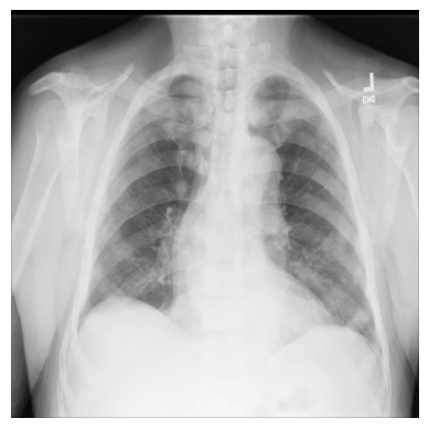 NumPy 应用：X射线图像处理_射线扫描里面的grayscale plot-CSDN博客