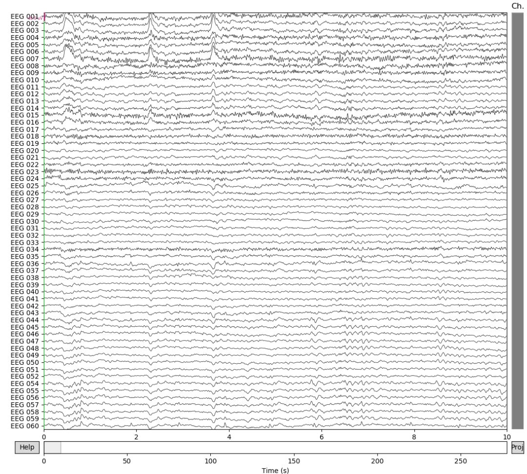 脑电分析系列[MNE-Python-9]| 参考电极应用-CSDN博客