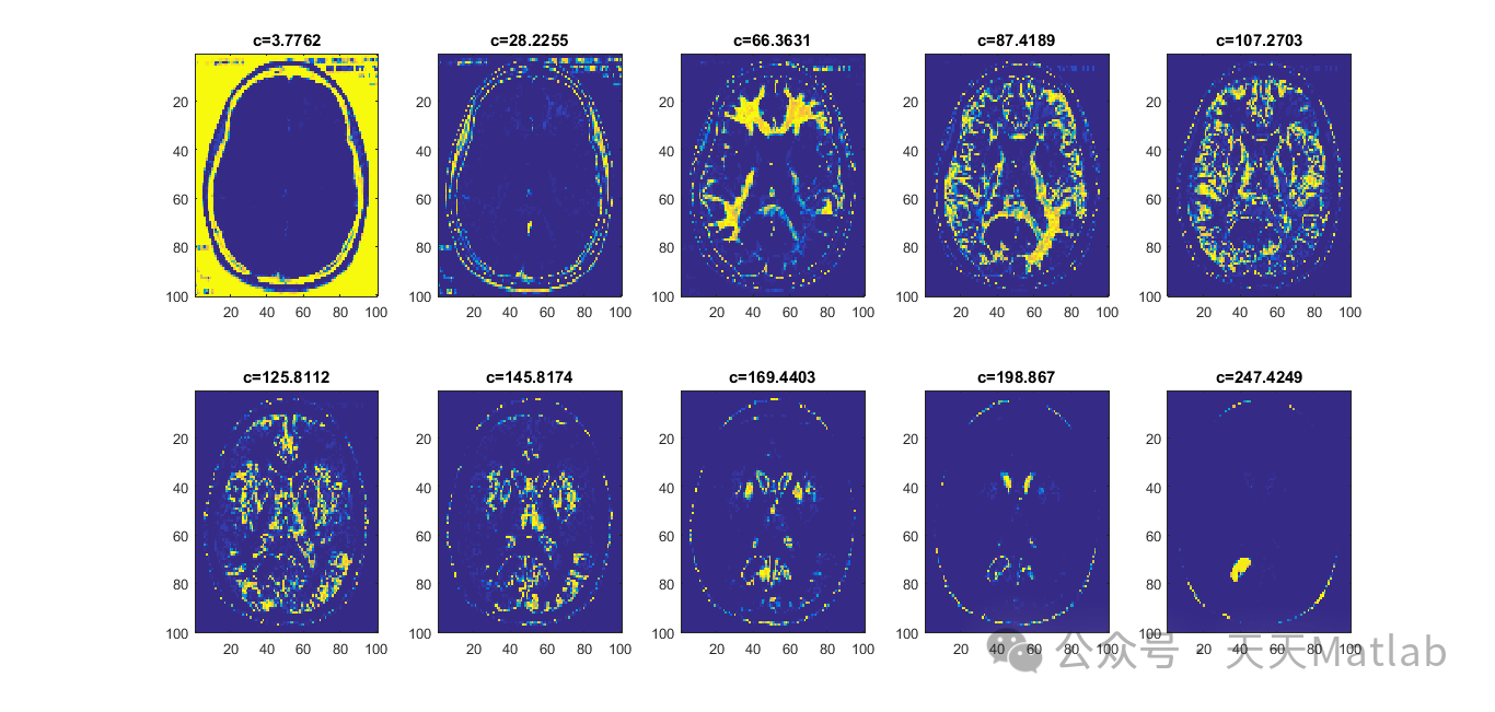 【图像分割】基于遗传算法优化模糊聚类算法ga Fcm实现脑肿瘤检测附matlab代码对脑部肿瘤ct诊断系统matlab Csdn博客