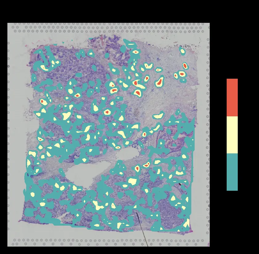 10X空间转录组细胞通讯之stlearn（寻找区域交流热点中心）-CSDN博客