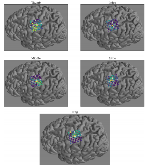 人工神网络来解码皮质电图(ECoG)数据_ecog的原理-CSDN博客
