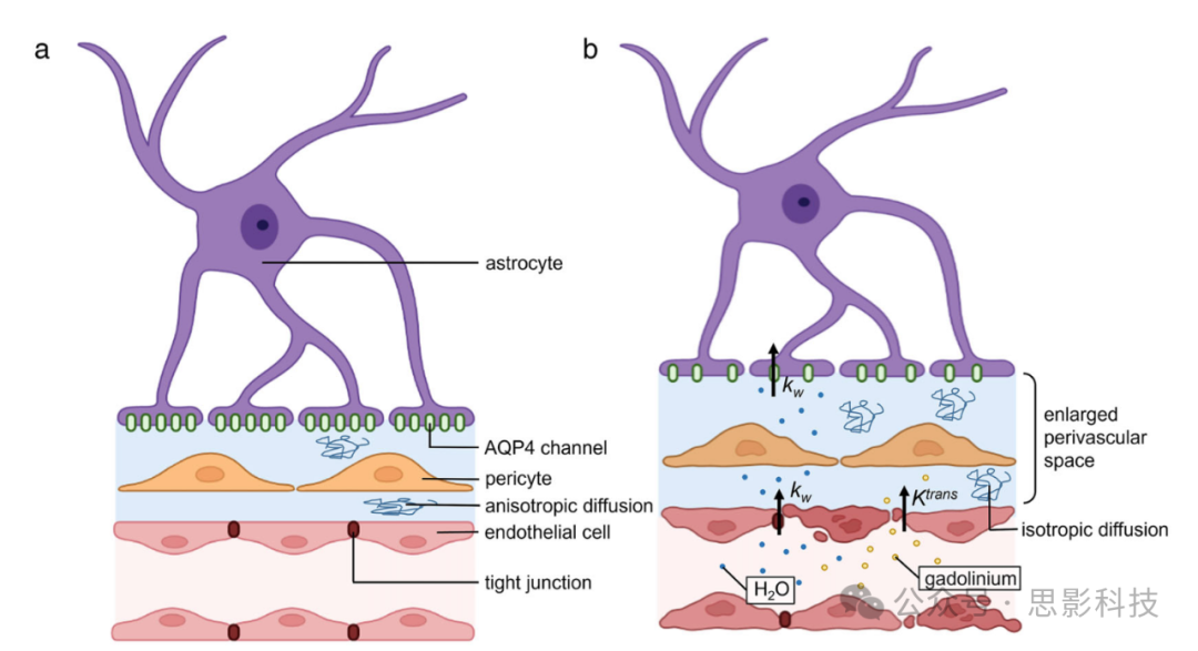小血管病和神经退行性疾病中的血脑屏障破坏和血管周围间隙（PVS)-CSDN博客