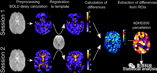 Human Brain Mapping：基于BOLD-Delay的脑灌注成像_「已注销」的博客-CSDN博客