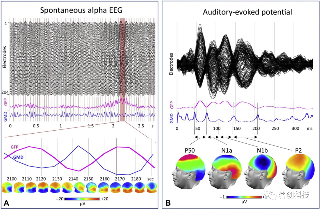 高分辨率EEG的空间分析-CSDN博客