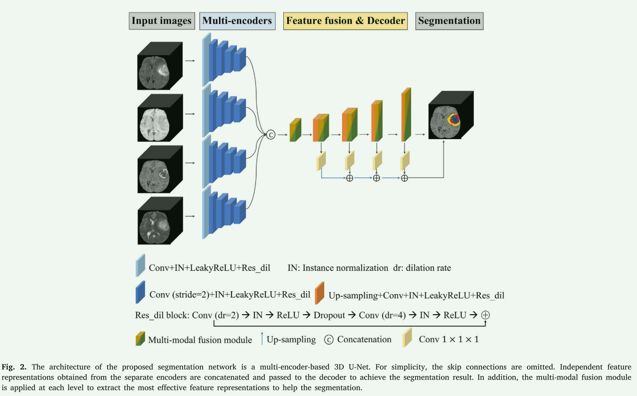 【论文阅读笔记】Uncertainty quantification and attention-aware fusion guided multi-modal MR brain tumor ...