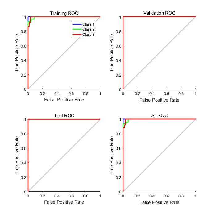 R语言临床诊断试验的ROC分析方法示例_对临床样本中tfs和mirnas的表达进行了单独和合并接收者操作特征曲线(roc)分析-CSDN博客