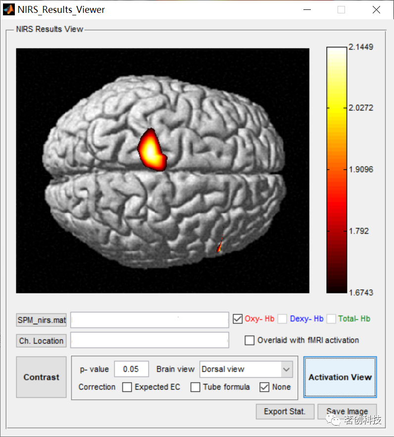 近红外干货 | NIRS_SPM单被试激活分析过程_nirs-spm-CSDN博客