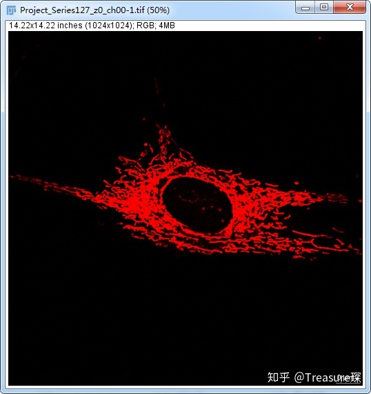 imagej中文_ImageJ实用技巧——线粒体网络形态分析(插件篇)_科技美学的博客-CSDN博客
