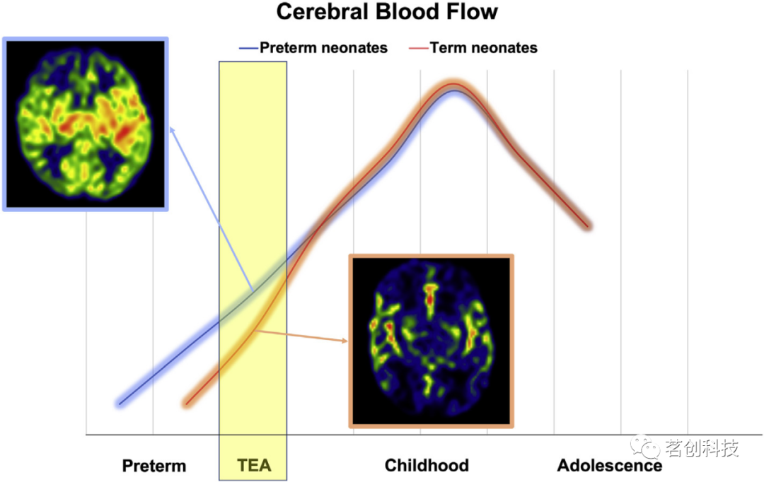 新生儿动脉自旋标记(ASL)灌注_新生儿大脑前动脉-CSDN博客