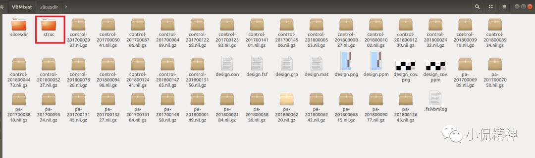 vbm 分析_手把手系列教程：使用FSL进行VBM分析_尹昉的博客-CSDN博客