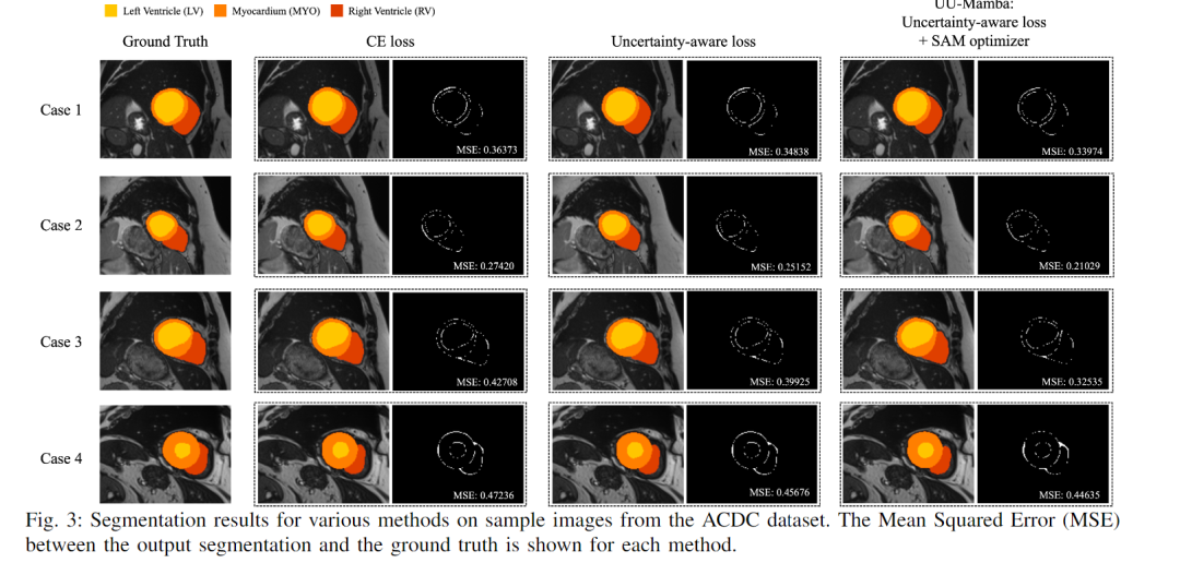 【魔改Mamba系列】UU-Mamba：用于图像分割的不确定性感知U-Mamba-CSDN博客