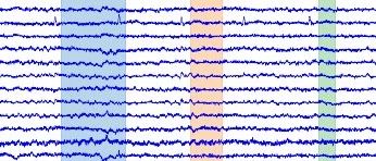 kaggle数据集汇总_脑电(EEG)等公开数据集汇总-CSDN博客